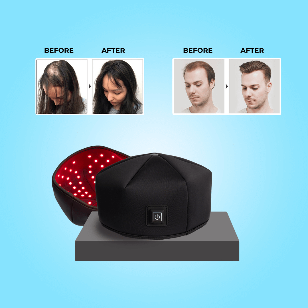 ReGain - Laser Hair Growth System Cap – mLab